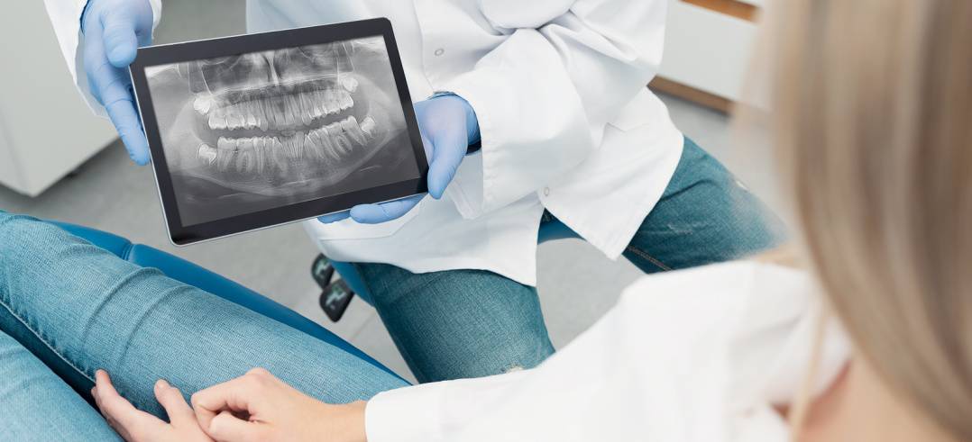 Cavity Treatment | San Ramon, CA | Pro Smile Dental Care